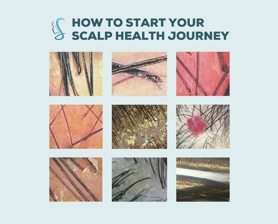Scalp Analysis San Diego: Expert Hair & Scalp Health Solutions